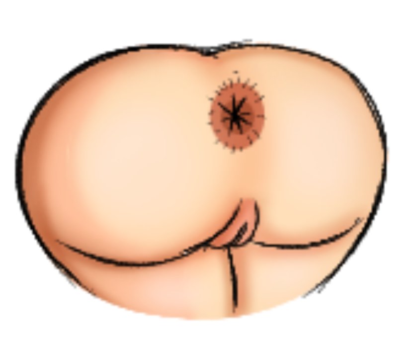 Rule 34 2d 2d Artwork 2d Artwork Anus Ass Asshole Basic Background 9835